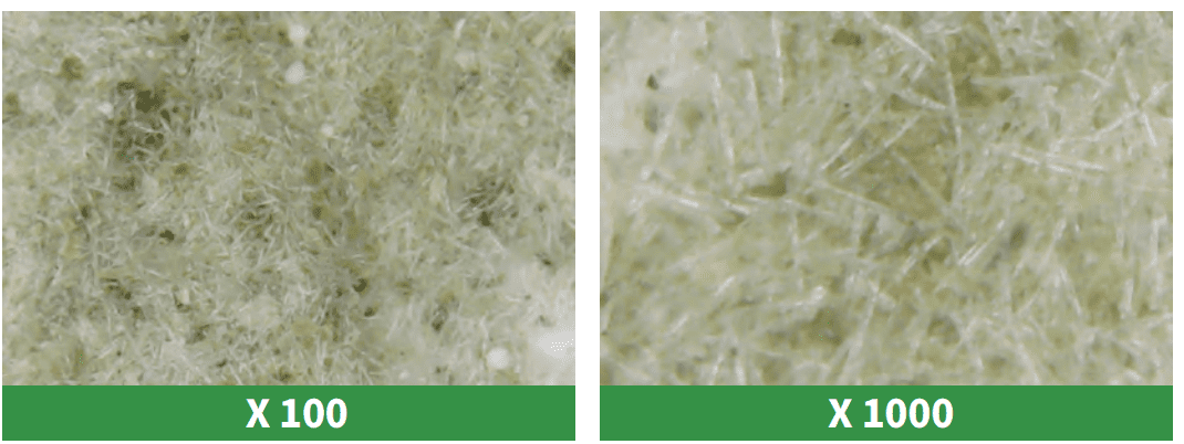 Bio-microneedling Spirella Spicule Peel - Clear Medical Skin Clinic